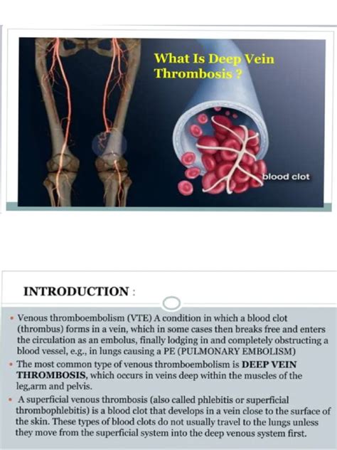 Dvt Pdf