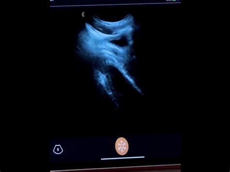 Dr Mike Markiplier Prostate Exam