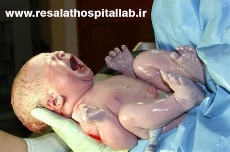 غربالگری کروموزوم های جنین از طریق خون مادراعداد نرمال آزمایش غربالگری اول