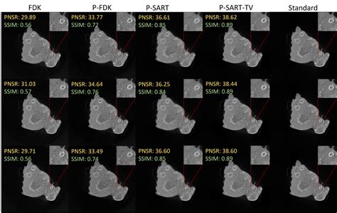 Simulation Results With Poisson Noise The Reconstruction Results Of