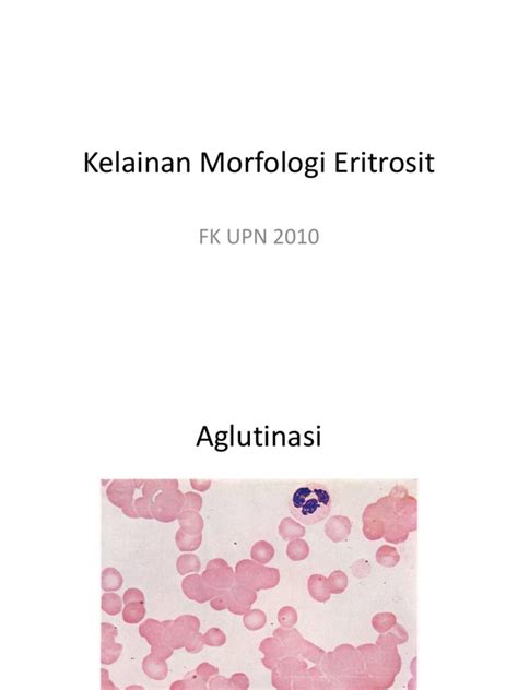 Kelainan Morfologi Eritrosit Pdf