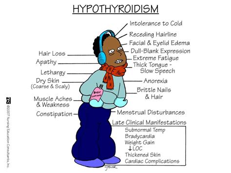 Hypothyroidism Abc Medicine