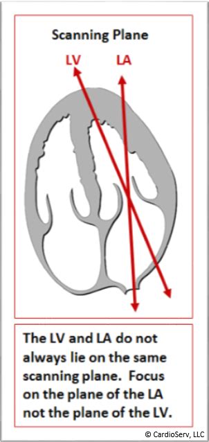 What S The Difference Between Lv And Lv Extra Space Paul Smith