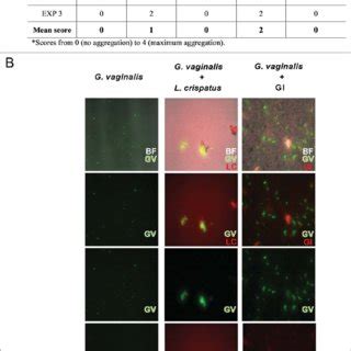 Schematic Representation Of GI Mechanism On G Vaginalis Infection GI Download Scientific