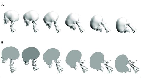 A The Stepwise Application Of Intervertebral Range Of Motion In The