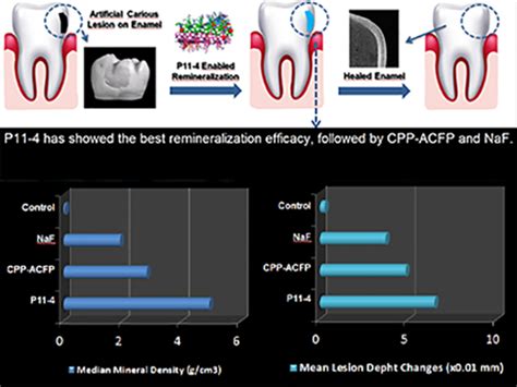 Analysis Of Efficacy Of The Self‐assembling Peptide‐based Remineralization Agent On Artificial