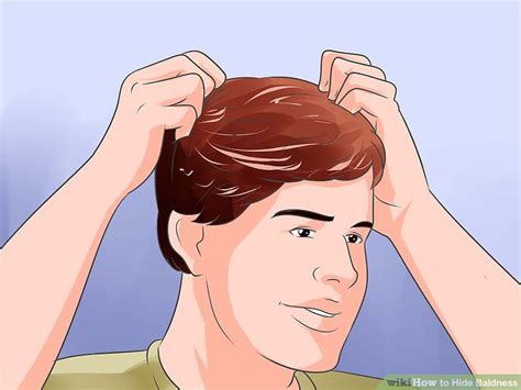 Ways To Hide Baldness WikiHow
