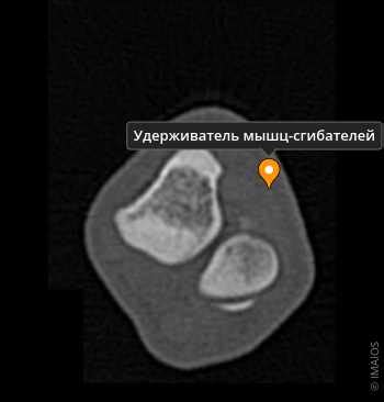 Удерживатель мышц-сгибателей - vet-Anatomy - IMAIOS