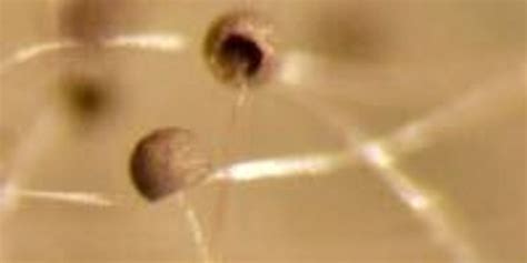 Researchers Provide New Insight Into Deadly Fungal Infections Lab Manager