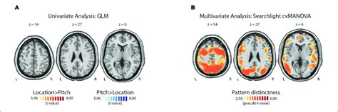 Topographies Of Uni And Multivariate Fmri Analysis Results A The