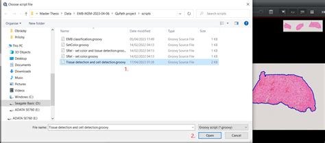 Segmentation In Qupath Monailabel Server