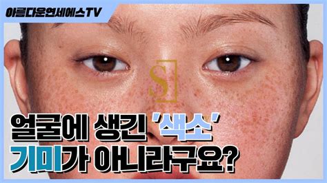 제 얼굴에 색소 Oo가 아니라네요 기미없애는법 검버섯없애는법 흑자없애는법 기미크림 【대전 세종 청주 천안 공주 유성】 피부과 Youtube