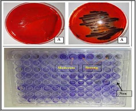 Virulence Factors Of E Coli A On Congo Red Agar Biofilm Production