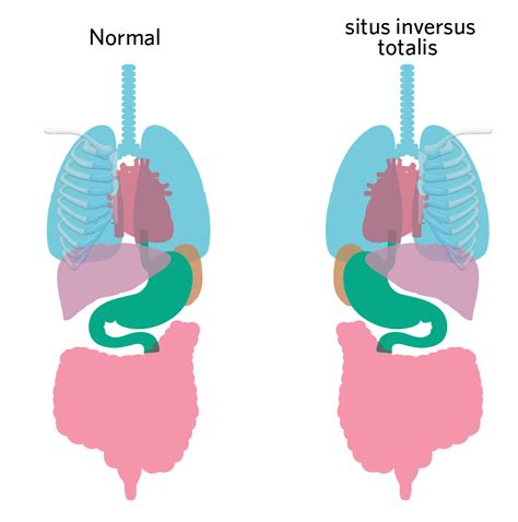 Cell Chirality Offers Clues To The Mystery Of Body Asymmetry The Scientist