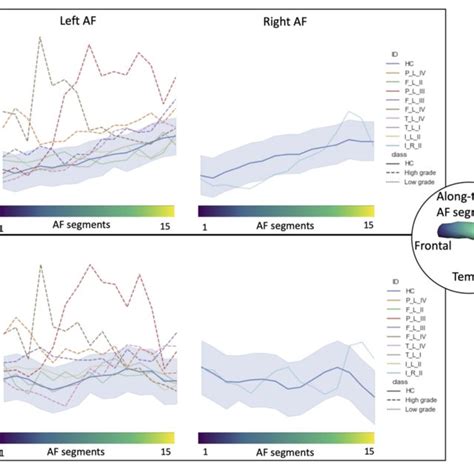 Along Tract Diffusion Tensor Imaging Dti Measures A Mean