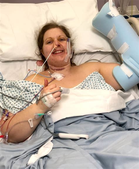 Tongue Cancer Is Rising In Young Women Its Unclear Why 45 Year Old