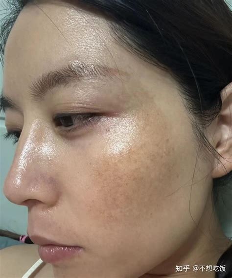 30岁 ，皮肤暗沉发黄、色斑、斑点严重？有什么好的美白淡斑方法？ 知乎