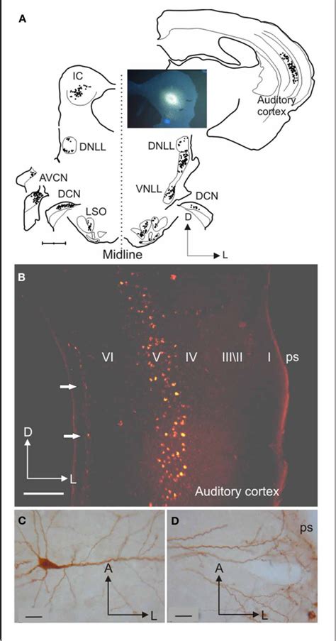 Figure 1 From Cortical Modulation Of Auditory Processing In The