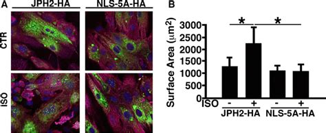Jph2 Nuclear Localization Is Critical For Isoproterenol Induced