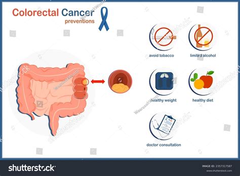Gráficos De Cáncer De Colon