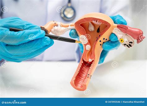 Uterus Doctor With Anatomy Model For Study Diagnosis And Treatment In
