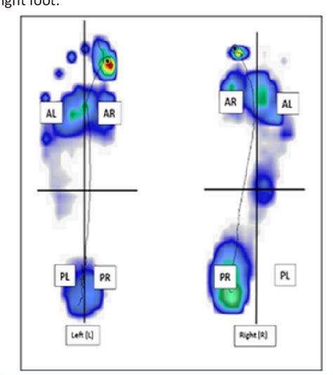 Table 1 From Relationship Between Spinal Disorders And Physical Attributes Semantic Scholar
