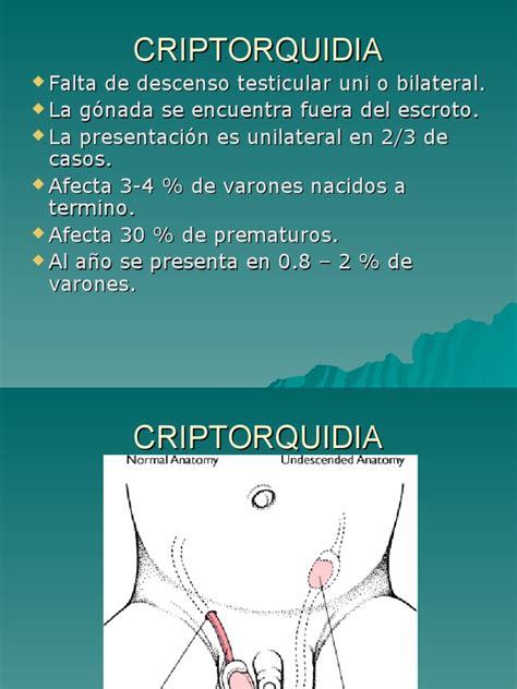Criptorquidia Pdf