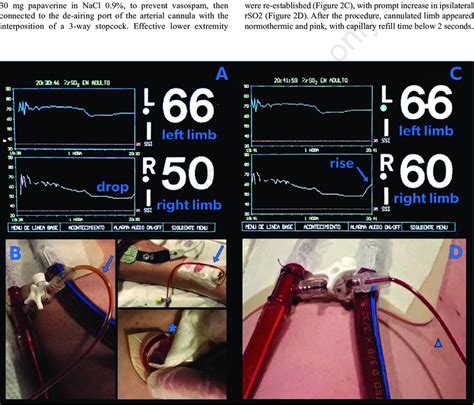A Regional Oxygen Saturation Rso2 Signal 1 Hour Trend And Instant Download Scientific