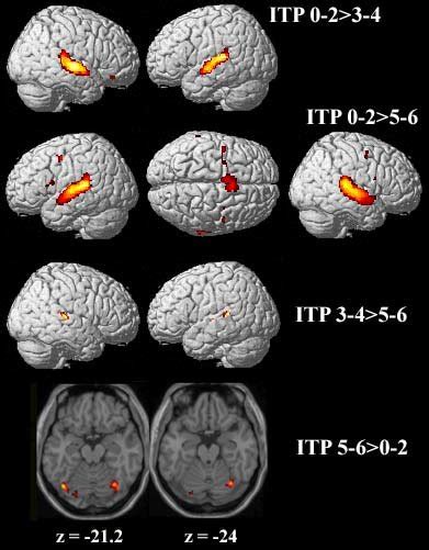 Brain Activation Pattern P