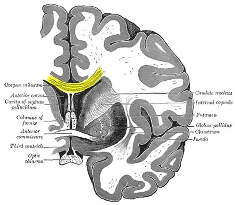 Split Brains Reconnect Via Alternate Routes Human World Earthsky
