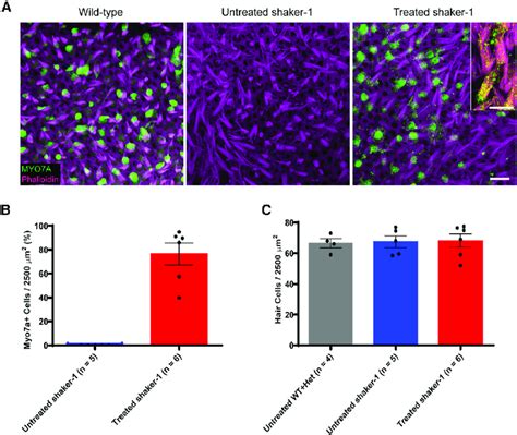 Dual Av8 Y733f Myo7a Vectors Restore Myo7a Expression In Transduced Download Scientific