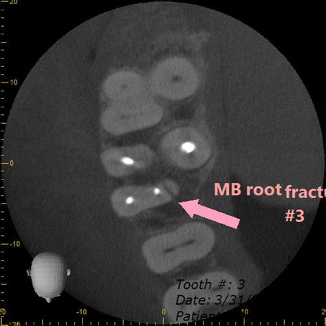Mastering Cbct Essential Fundamentals For Successful 3d Dental Radiography