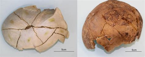 Comminuted Fracture Assembled To Observe The General Fracture Pattern Download Scientific