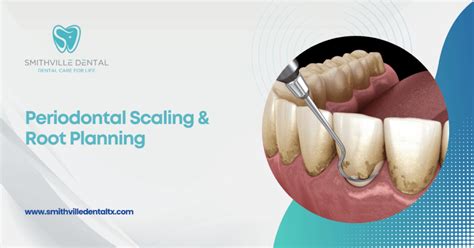 Periodontal Scaling And Root Planning Smithville Dentist