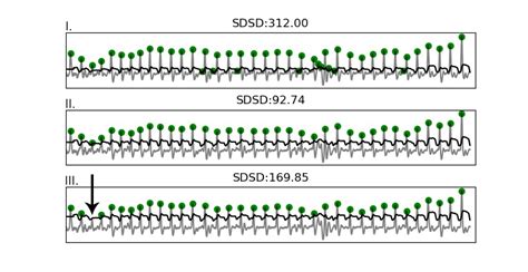 Algorithm Functioning Python Heart Rate Analysis Toolkit Documentation