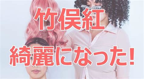 竹俣紅が綺麗になった！昔の顔画像比較と整形検証！ ネットブレイク