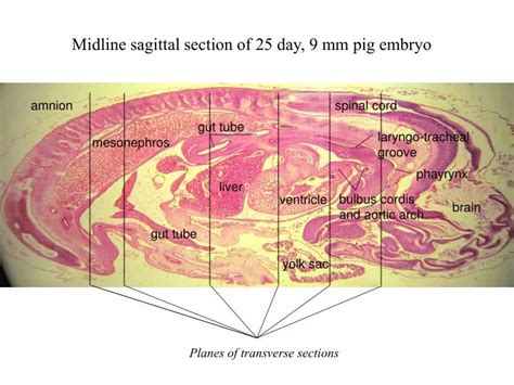 Ppt Mesonephros Powerpoint Presentation Free Download Id6223898
