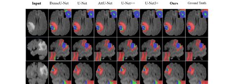 Segmentation Results On The Msd Task01 Dataset Download Scientific