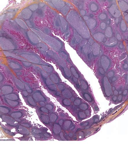 Lymphatic Immune System Histology Flashcards Quizlet