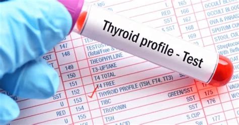 Tft Test In Patiala Best Medical Lab For Tft Test In Patiala