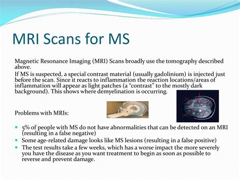 Ppt Pair Distribution Function Computed Tomography Scans Powerpoint Presentation Id 2637895