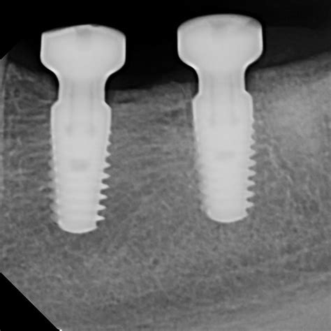 Arash Khoshnevis Dmd Ms Drarashkh • Instagram Photos And Videos