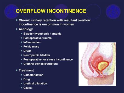Overflow Incontinence Treatment Guidelines Dikiivy