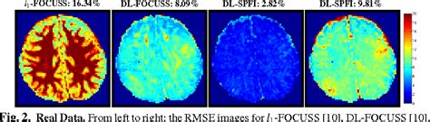 Regularized Spherical Polar Fourier Diffusion Mri With Optimal Dictionary Learning