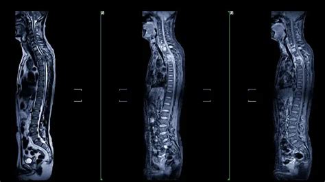 Mri 사진 Unsplash에서 무료 이미지 다운로드
