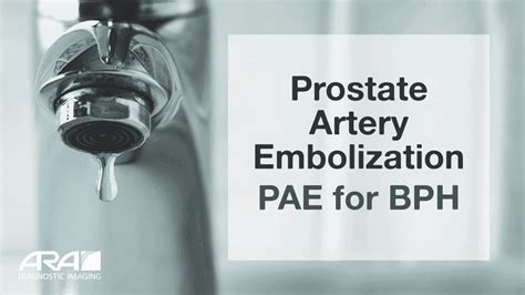 Ara Diagnostic Imaging Shares How Prostate Artery Embolization Provides Minimally Invasive