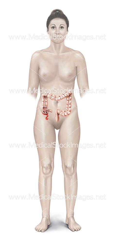 Female Inflamed Appendix Medical Stock Images Company