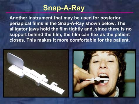 Radio Graphic Techniques Bisecting And Occlusal Pdf Operating Systems Computer Software