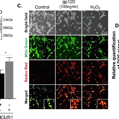 An Aberrant Expression Of Mcu Proteins In Gp120 Treated Cells A