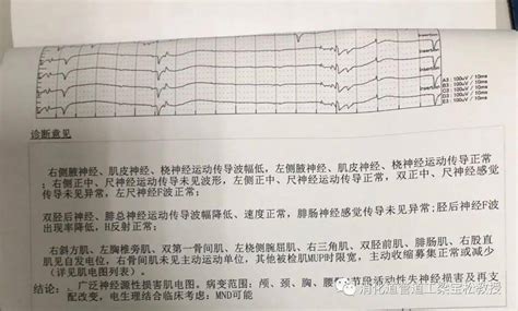 年轻的“渐冻症”患者 诊断